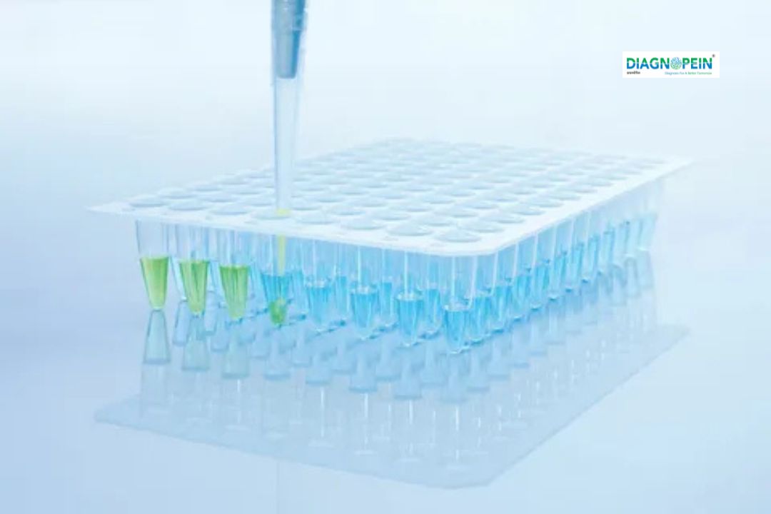 CMV Quantitative (RT-PCR) Test – Accurate Cytomegalovirus Detection ...