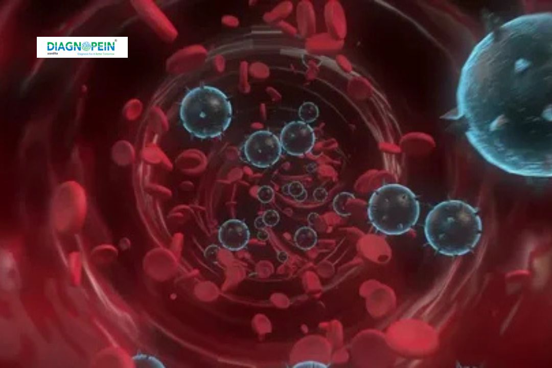 HIV ELISA CMIA Test in Karad | Accurate HIV Diagnosis at Diagnopein