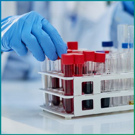 C3 Complement Test Delhi | Diagnopein